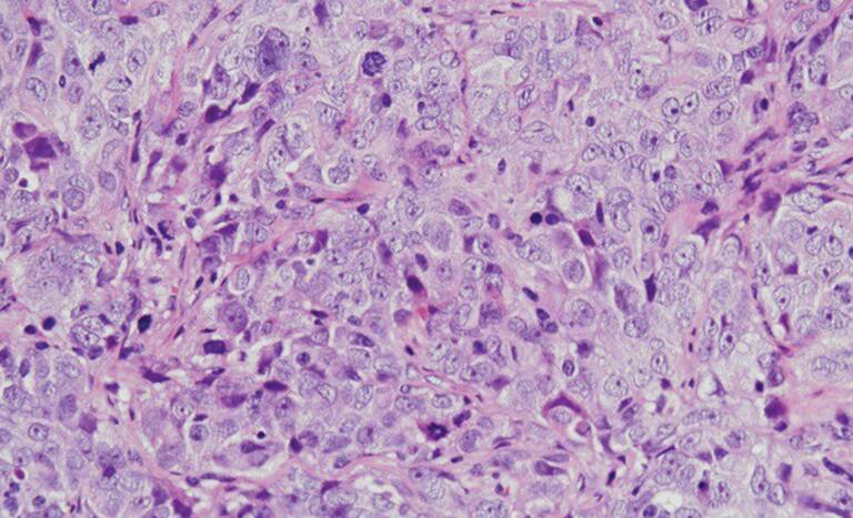 Investigadores del CSIC identifican una proteína implicada en la ... Investigadores del CSIC identifican una proteína implicada en la ...